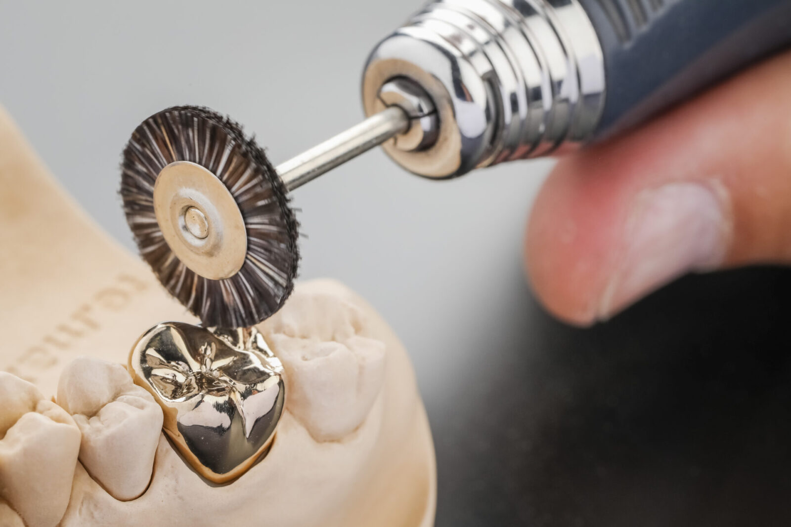 GOLD – Precision Dental